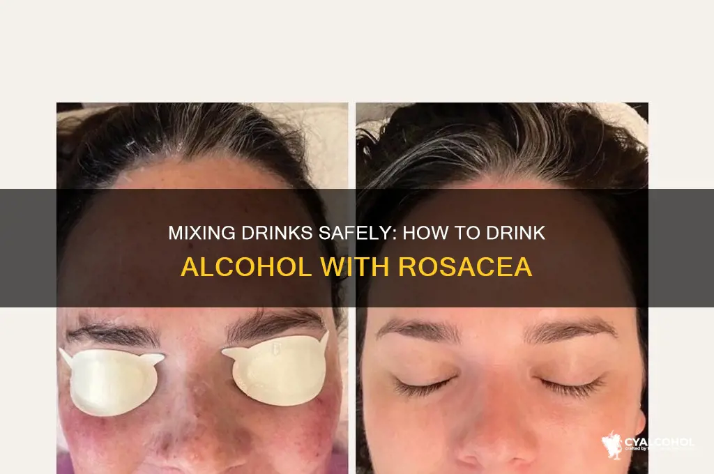 Mixing Drinks Safely: How To Drink Alcohol With Rosacea | CyAlcohol
