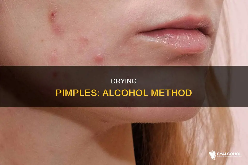 Drying Pimples: Alcohol Method | CyAlcohol
