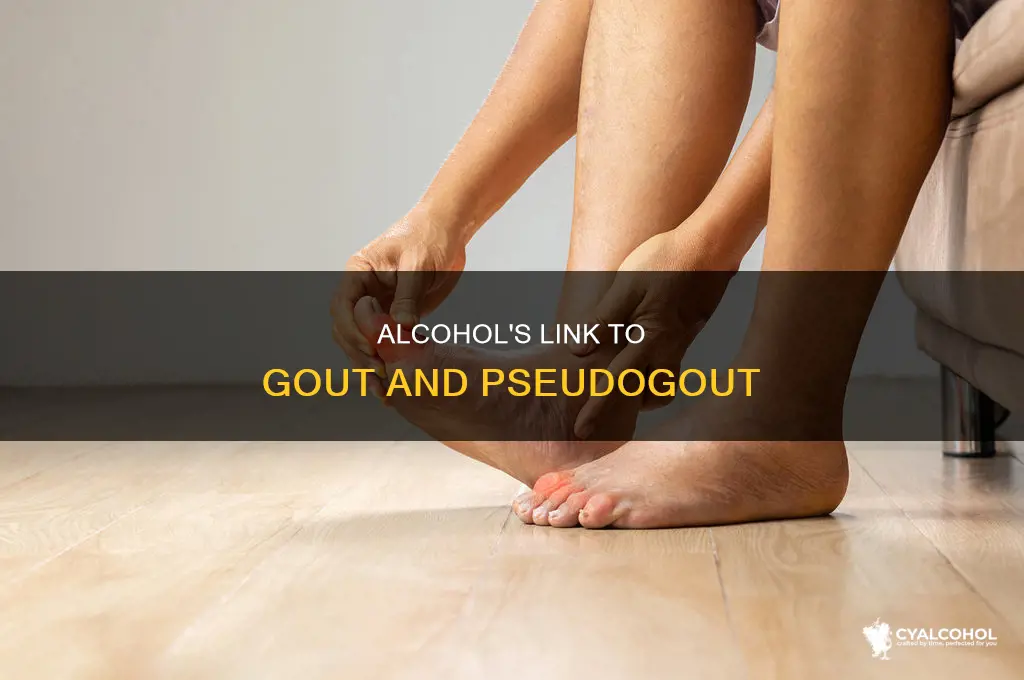 Alcohol's Link To Gout And Pseudogout | CyAlcohol
