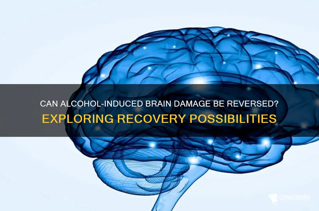 Can Alcohol-Induced Brain Damage Be Reversed? Exploring Recovery ...