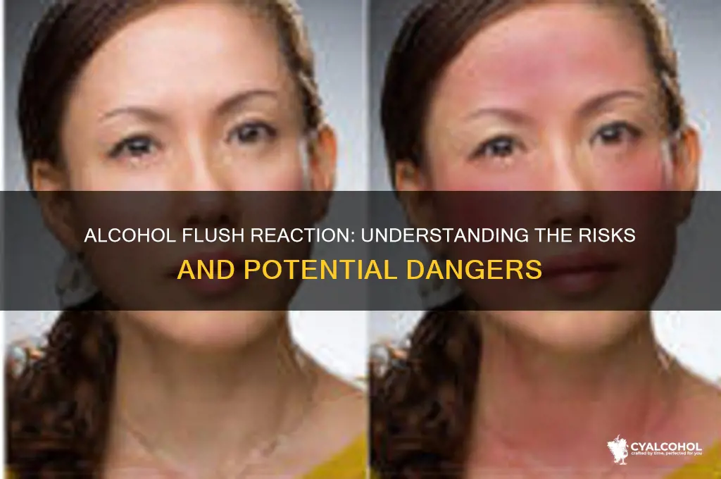 Alcohol Flush Reaction: Understanding The Risks And Potential Dangers ...
