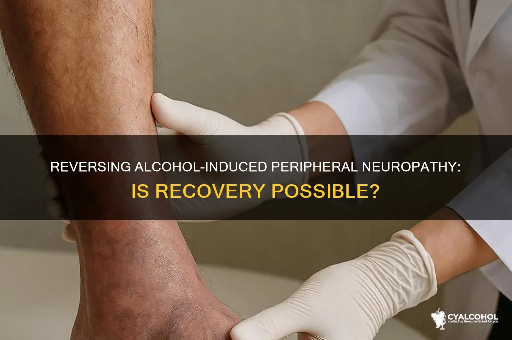 Reversing Alcohol-Induced Peripheral Neuropathy: Is Recovery Possible ...
