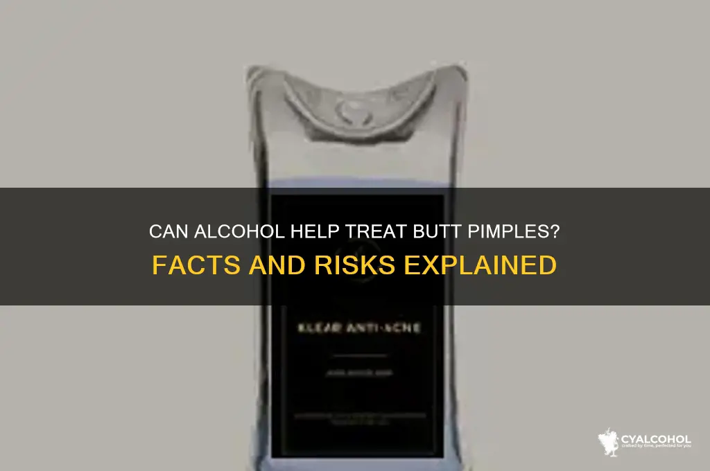 Can Alcohol Help Treat Butt Pimples? Facts And Risks Explained | CyAlcohol
