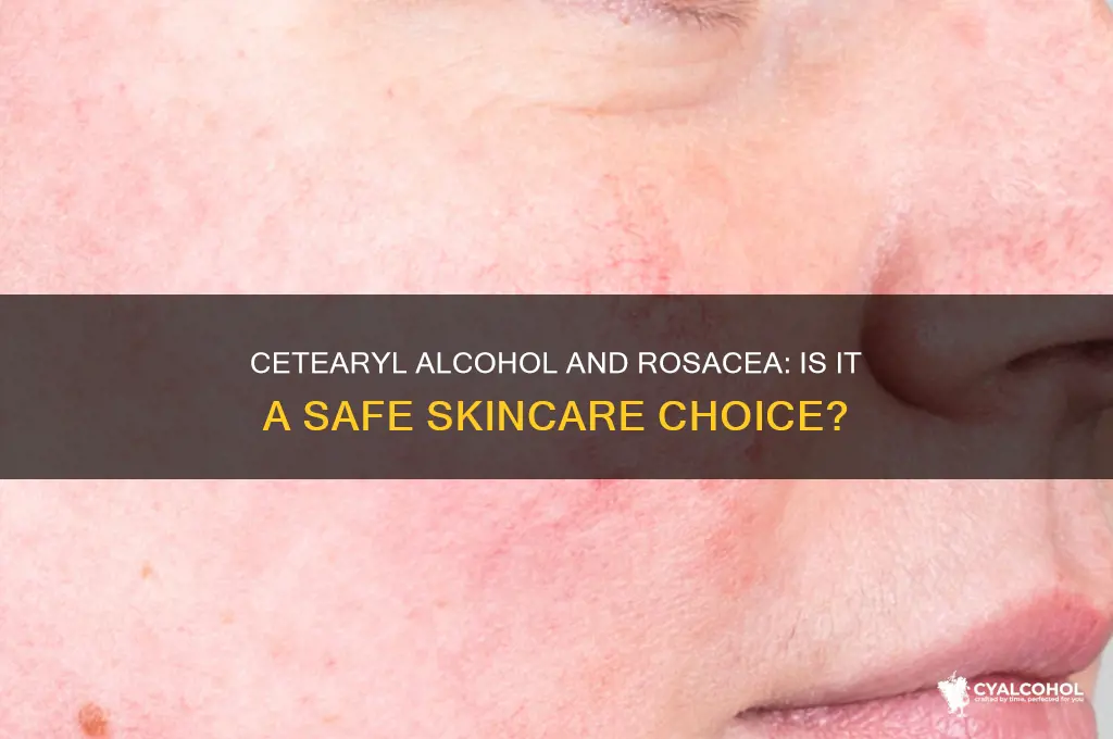 Cetearyl Alcohol And Rosacea: Is It A Safe Skincare Choice? | CyAlcohol