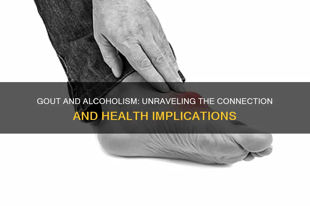 Gout And Alcoholism: Unraveling The Connection And Health Implications ...
