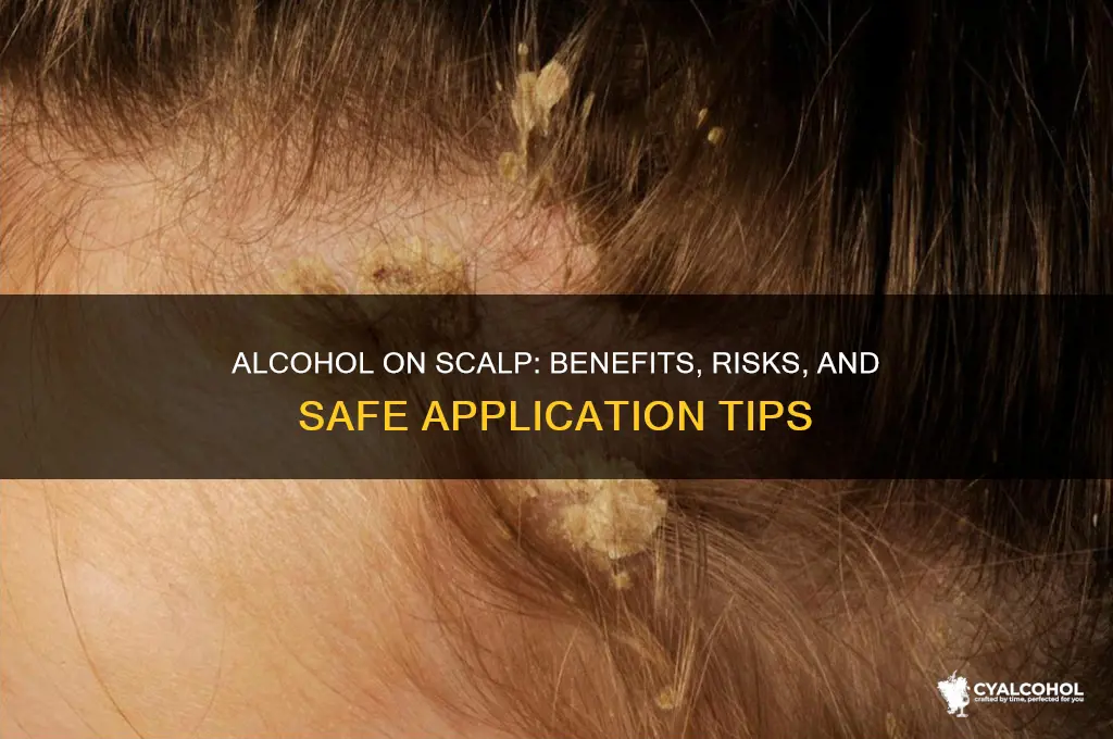 Alcohol On Scalp: Benefits, Risks, And Safe Application Tips | CyAlcohol