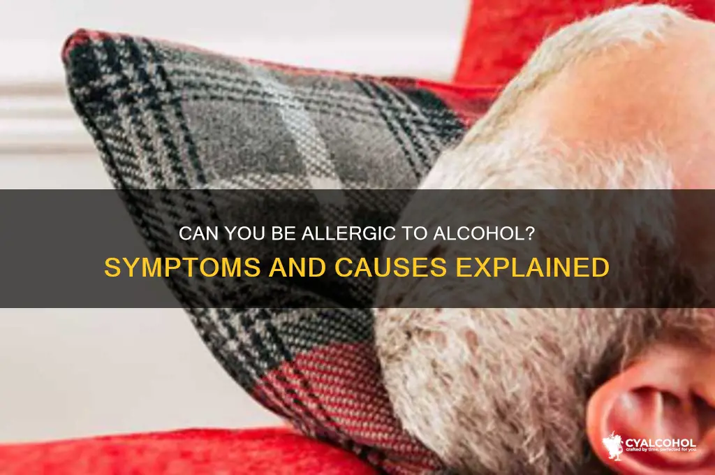 Can You Be Allergic To Alcohol? Symptoms And Causes Explained | CyAlcohol
