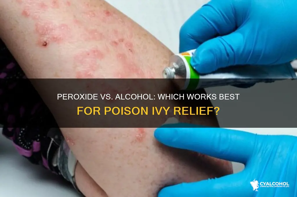 Peroxide Vs. Alcohol: Which Works Best For Poison Ivy Relief? | CyAlcohol