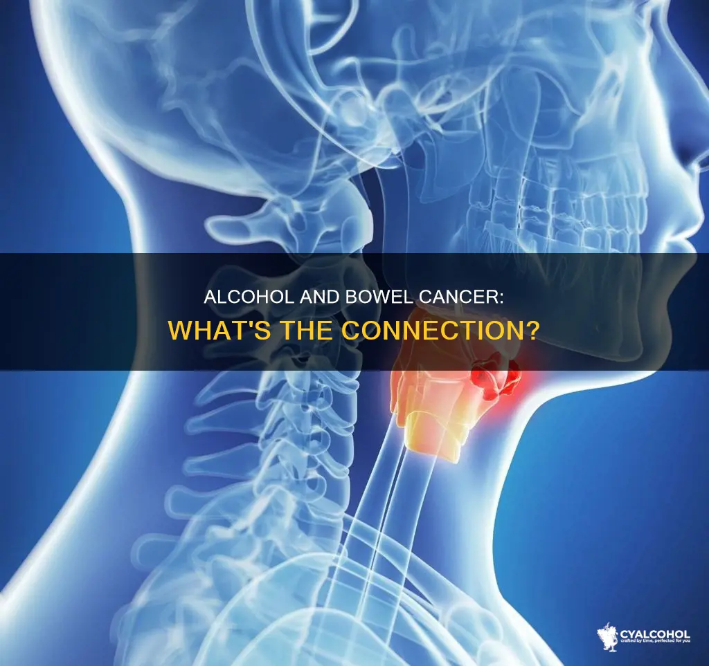 Alcohol And Bowel Cancer: What's The Connection? | CyAlcohol