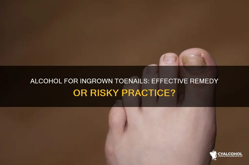 Alcohol For Ingrown Toenails: Effective Remedy Or Risky Practice ...