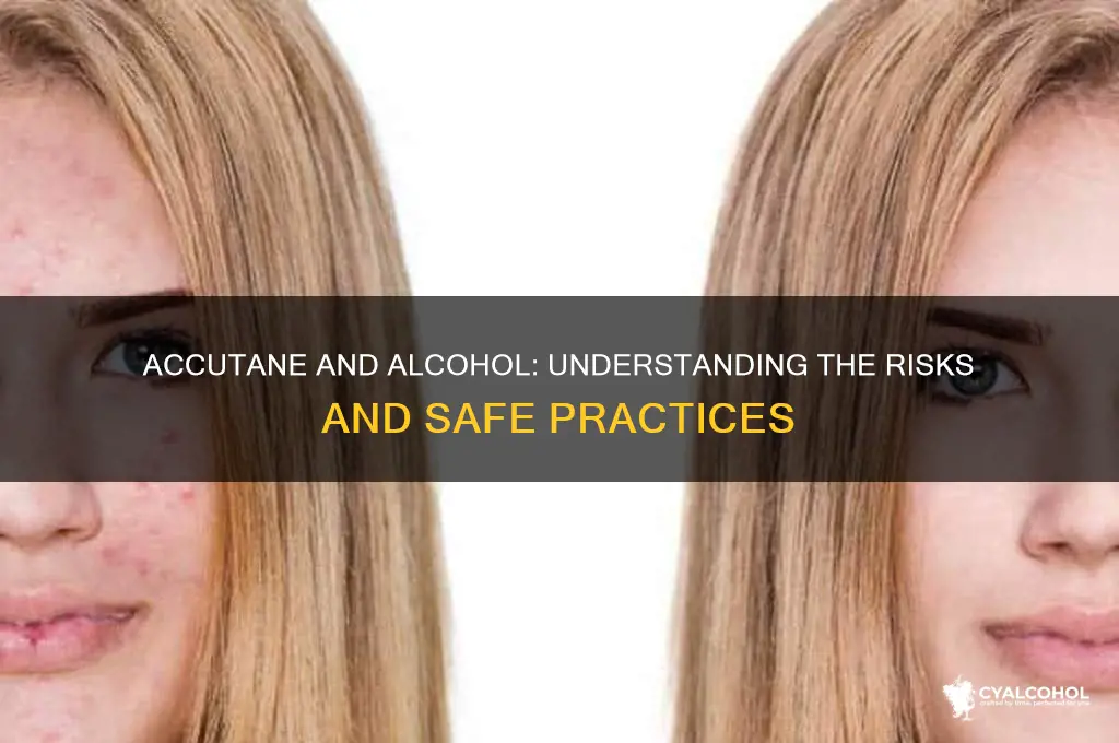 Accutane And Alcohol: Understanding The Risks And Safe Practices ...