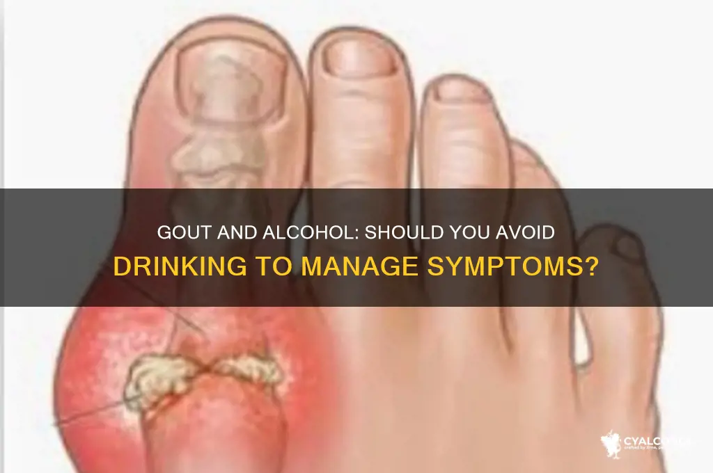 Gout And Alcohol: Should You Avoid Drinking To Manage Symptoms? | CyAlcohol