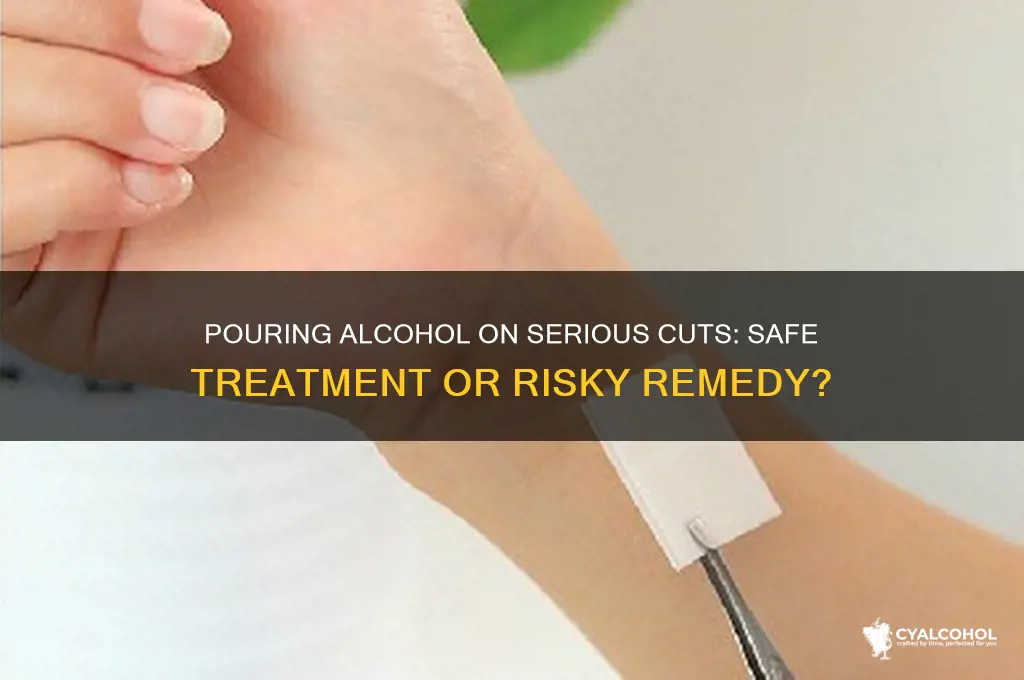 Pouring Alcohol On Serious Cuts: Safe Treatment Or Risky Remedy ...