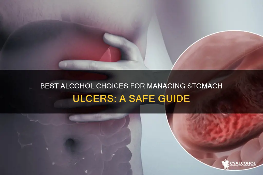 Best Alcohol Choices For Managing Stomach Ulcers: A Safe Guide | CyAlcohol