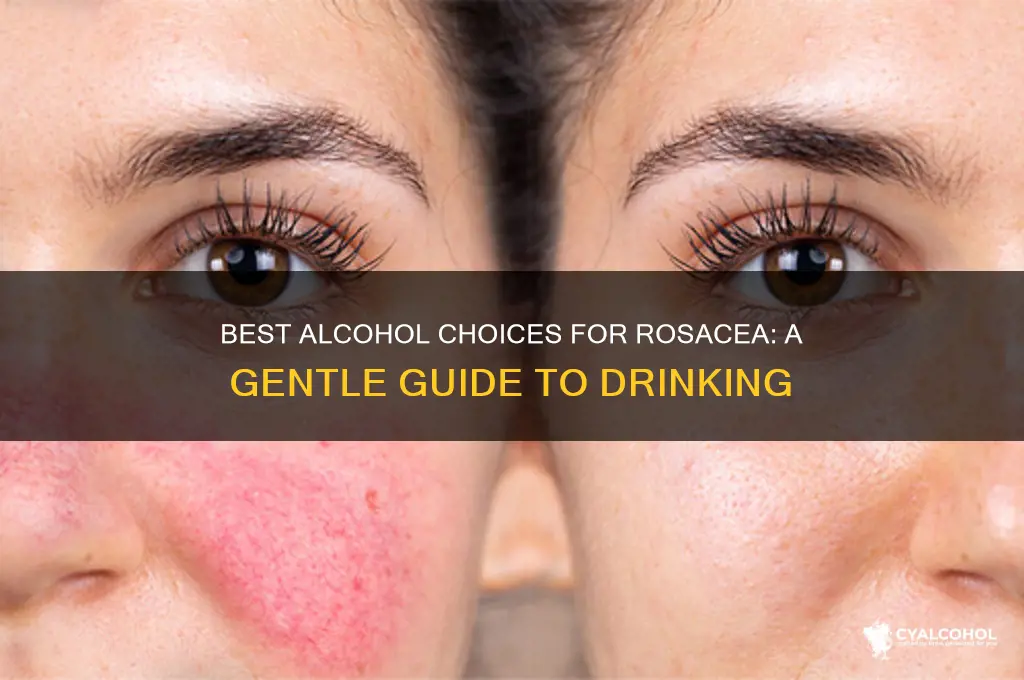 Best Alcohol Choices For Rosacea: A Gentle Guide To Drinking | CyAlcohol