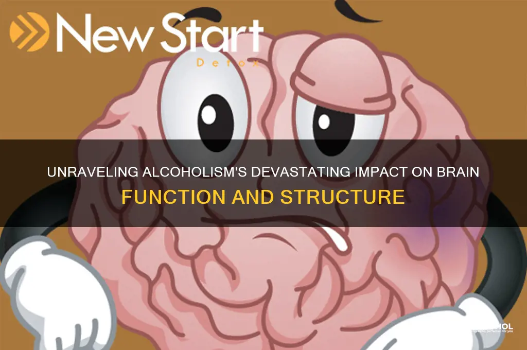 Unraveling Alcoholism's Devastating Impact On Brain Function And ...