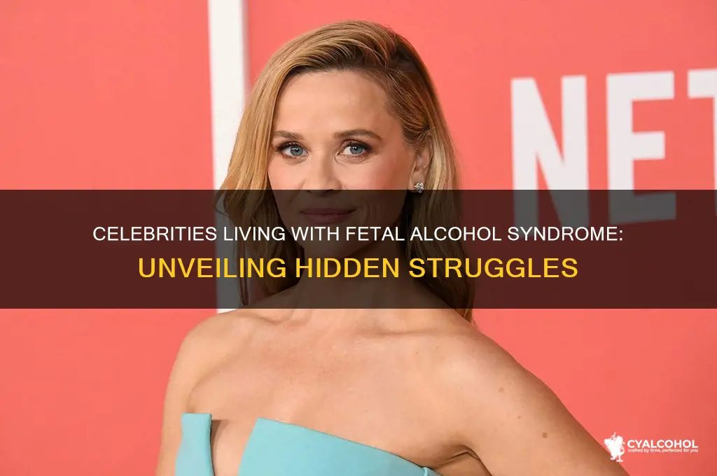 Celebrities Living With Fetal Alcohol Syndrome: Unveiling Hidden ...