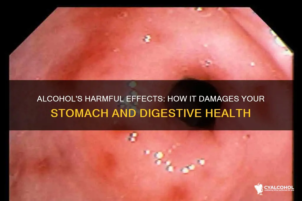 Alcohol's Harmful Effects: How It Damages Your Stomach And Digestive ...