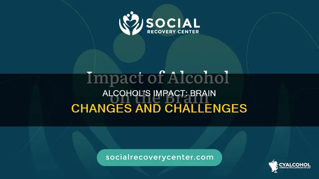 Alcohol's Impact: Brain Changes And Challenges | CyAlcohol