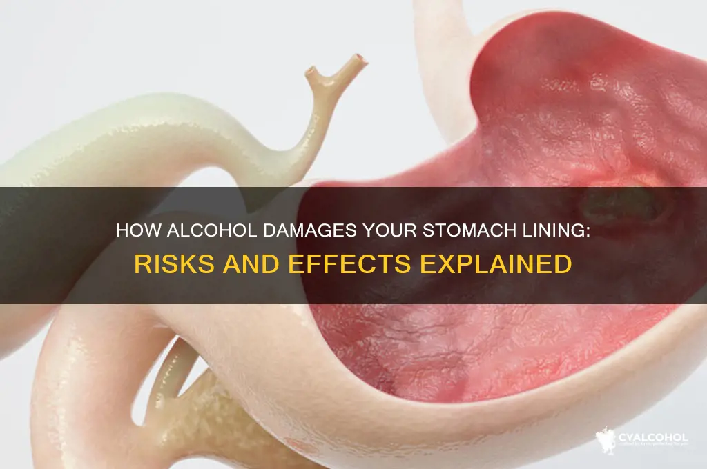 How Alcohol Damages Your Stomach Lining: Risks And Effects Explained ...