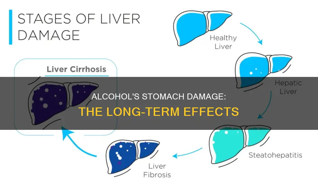Alcohol's Stomach Damage: The Long-Term Effects | CyAlcohol