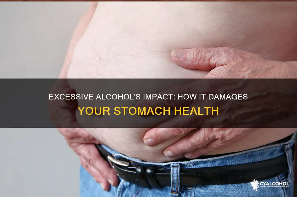 Excessive Alcohol's Impact: How It Damages Your Stomach Health | CyAlcohol