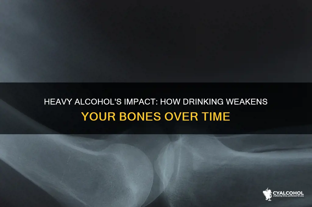 Heavy Alcohol's Impact: How Drinking Weakens Your Bones Over Time ...