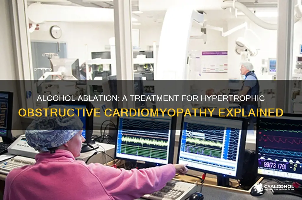 Alcohol Ablation: A Treatment For Hypertrophic Obstructive ...