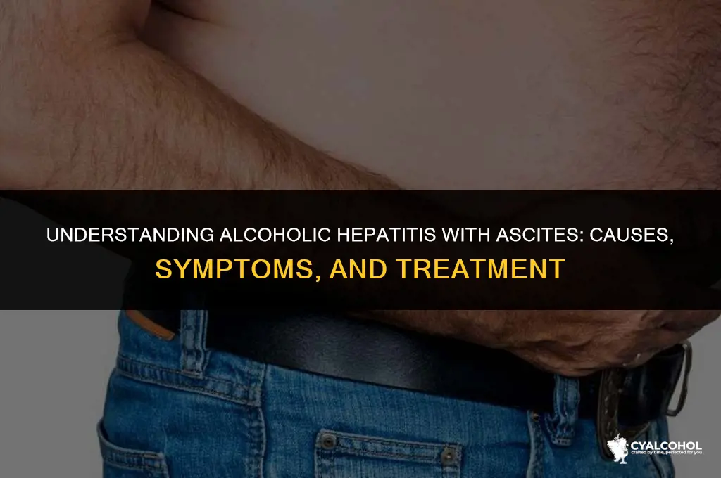 Understanding Alcoholic Hepatitis With Ascites: Causes, Symptoms, And ...