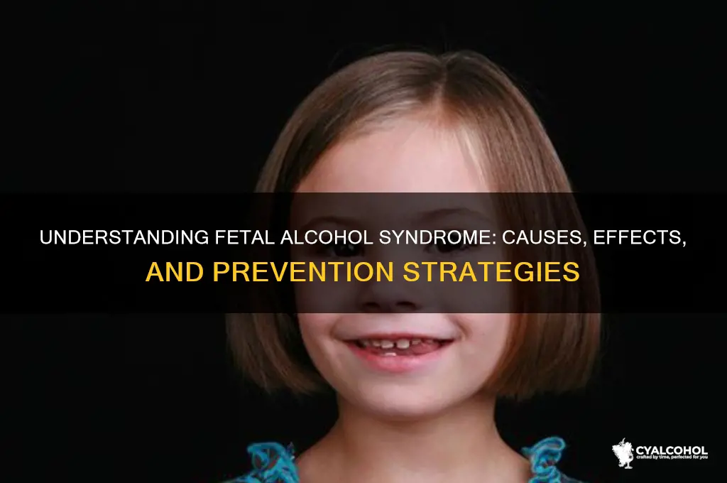 Understanding Fetal Alcohol Syndrome: Causes, Effects, And Prevention ...