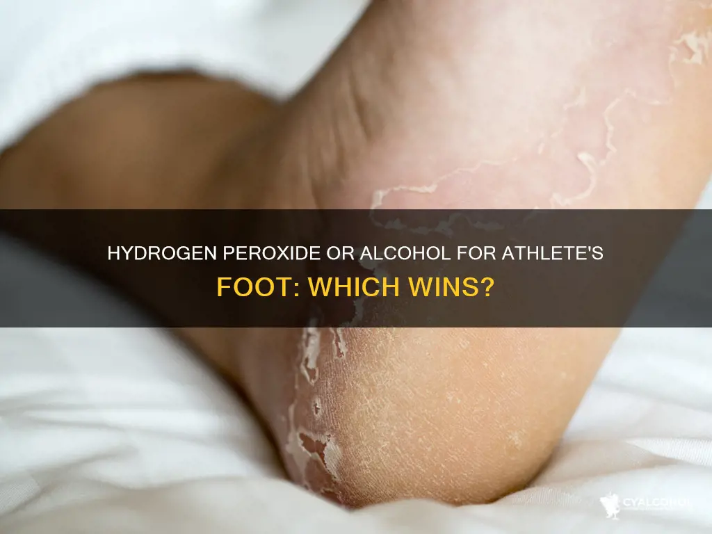 Hydrogen Peroxide Or Alcohol For Athlete's Foot: Which Wins? | CyAlcohol