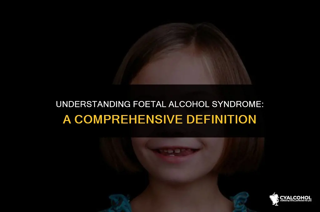 Understanding Foetal Alcohol Syndrome: A Comprehensive Definition ...