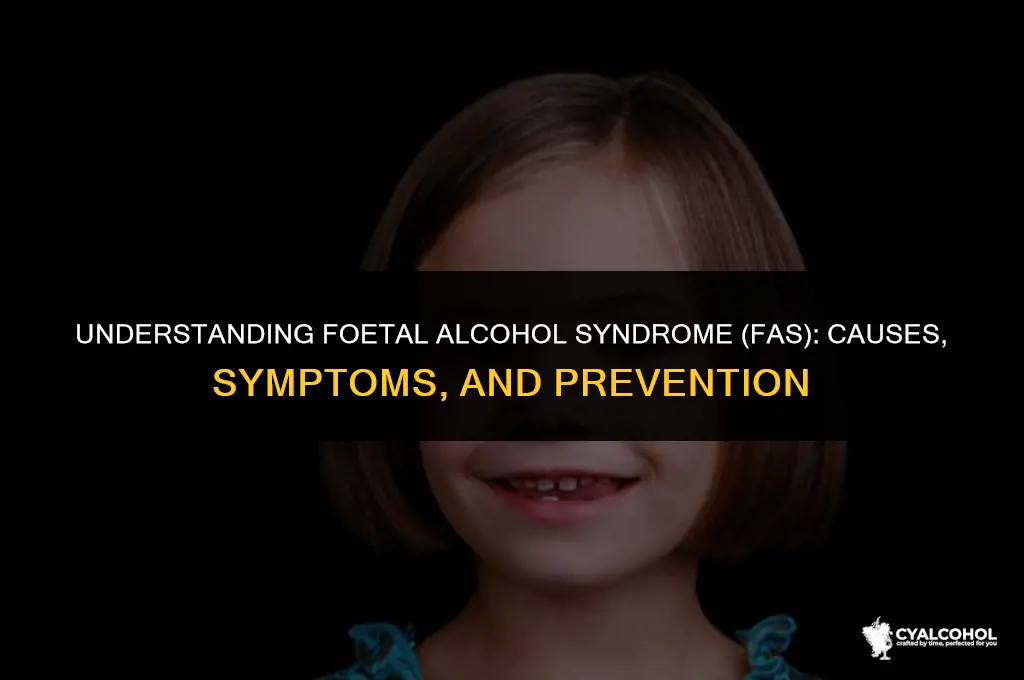 Understanding Foetal Alcohol Syndrome (Fas): Causes, Symptoms, And ...