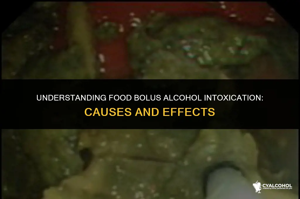 Understanding Food Bolus Alcohol Intoxication: Causes And Effects ...