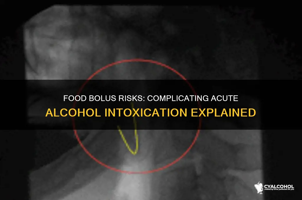 Food Bolus Risks: Complicating Acute Alcohol Intoxication Explained ...