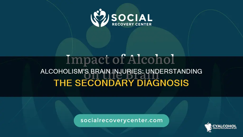 Alcoholism's Brain Injuries: Understanding The Secondary Diagnosis ...