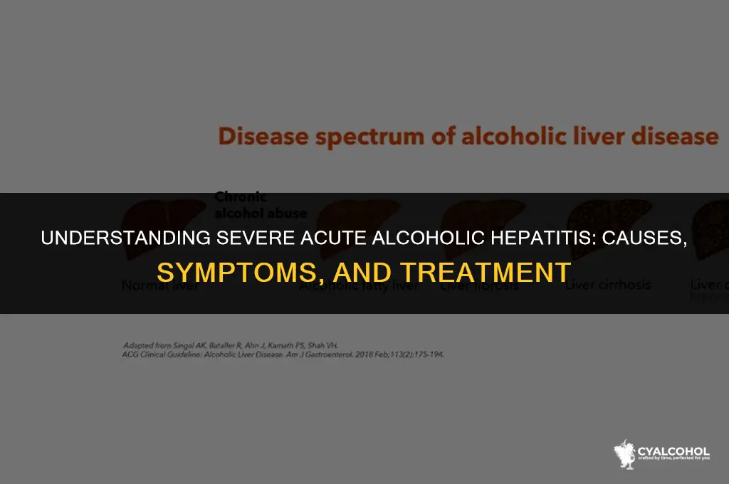 Understanding Severe Acute Alcoholic Hepatitis: Causes, Symptoms, And ...