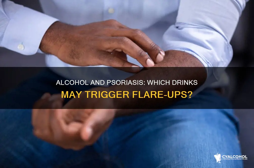 Alcohol And Psoriasis: Which Drinks May Trigger Flare-Ups? | CyAlcohol
