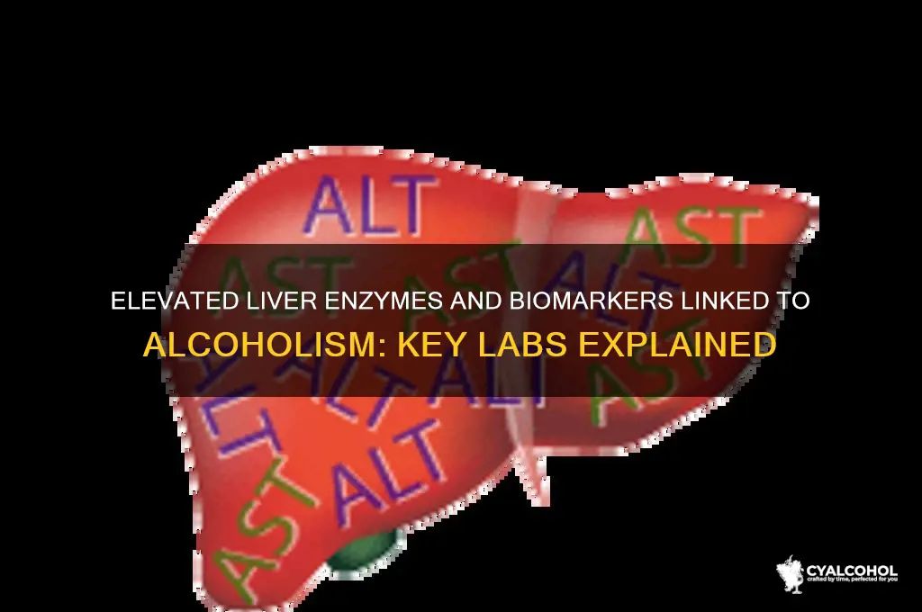 Elevated Liver Enzymes And Biomarkers Linked To Alcoholism: Key Labs ...