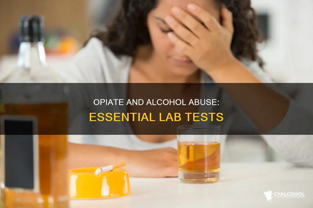 Opiate And Alcohol Abuse: Essential Lab Tests | CyAlcohol