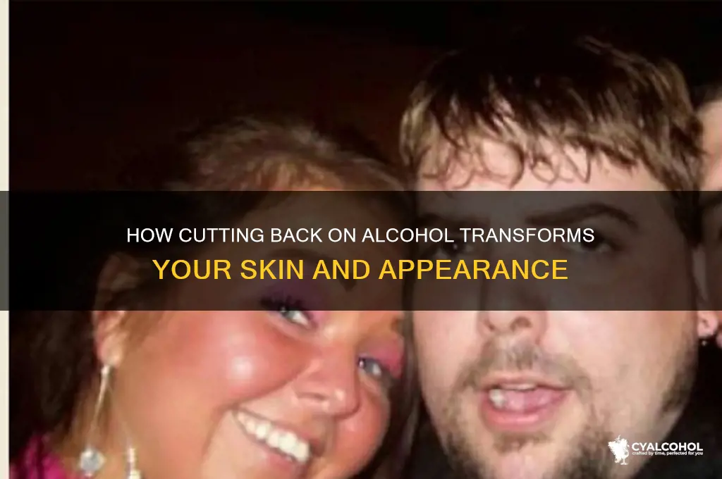 How Cutting Back On Alcohol Transforms Your Skin And Appearance | CyAlcohol