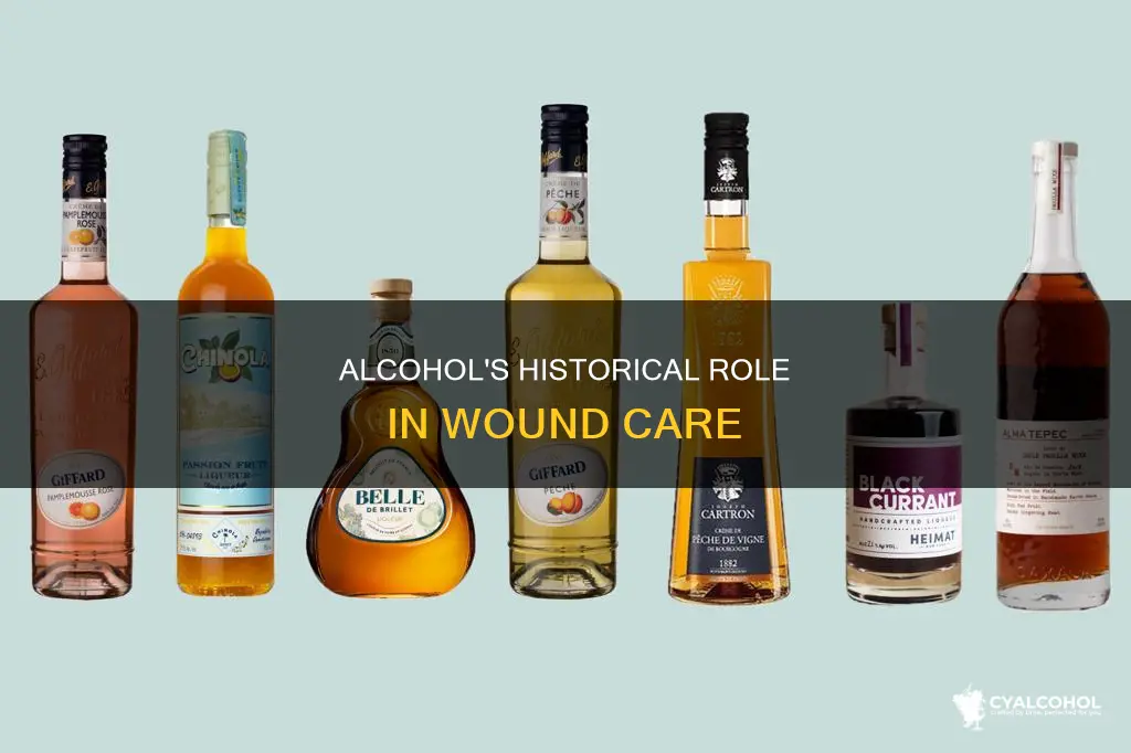Alcohol's Historical Role In Wound Care | CyAlcohol