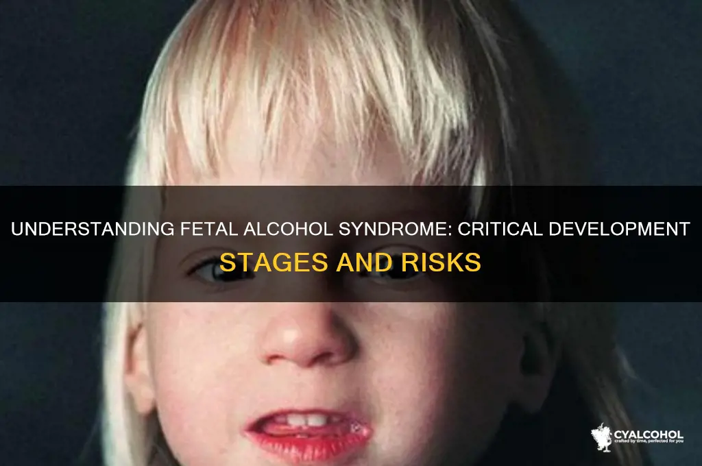 Understanding Fetal Alcohol Syndrome: Critical Development Stages And ...
