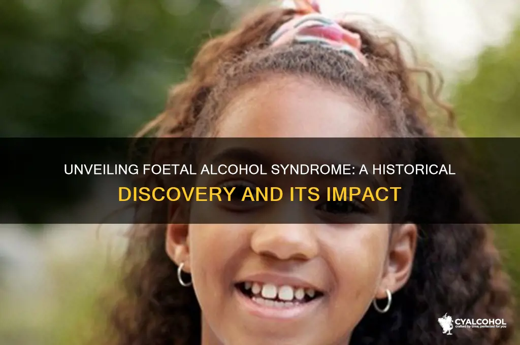 Unveiling Foetal Alcohol Syndrome: A Historical Discovery And Its ...