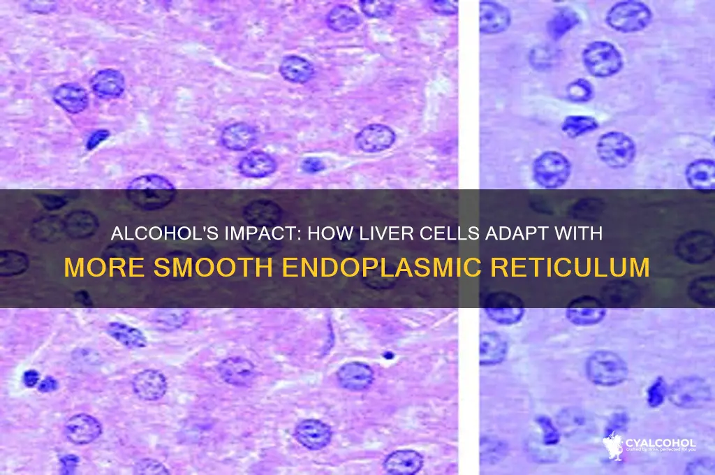 Alcohol's Impact: How Liver Cells Adapt With More Smooth Endoplasmic ...