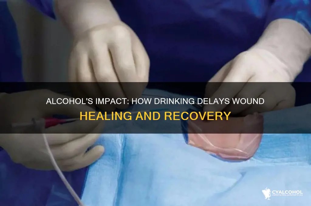 Alcohol's Impact: How Drinking Delays Wound Healing And Recovery ...