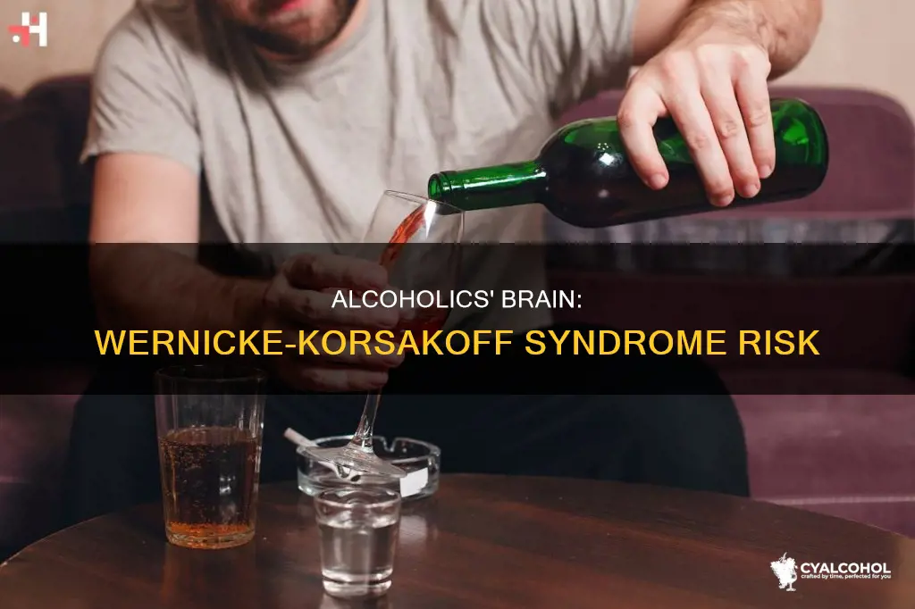 Alcoholics' Brain: Wernicke-Korsakoff Syndrome Risk | CyAlcohol