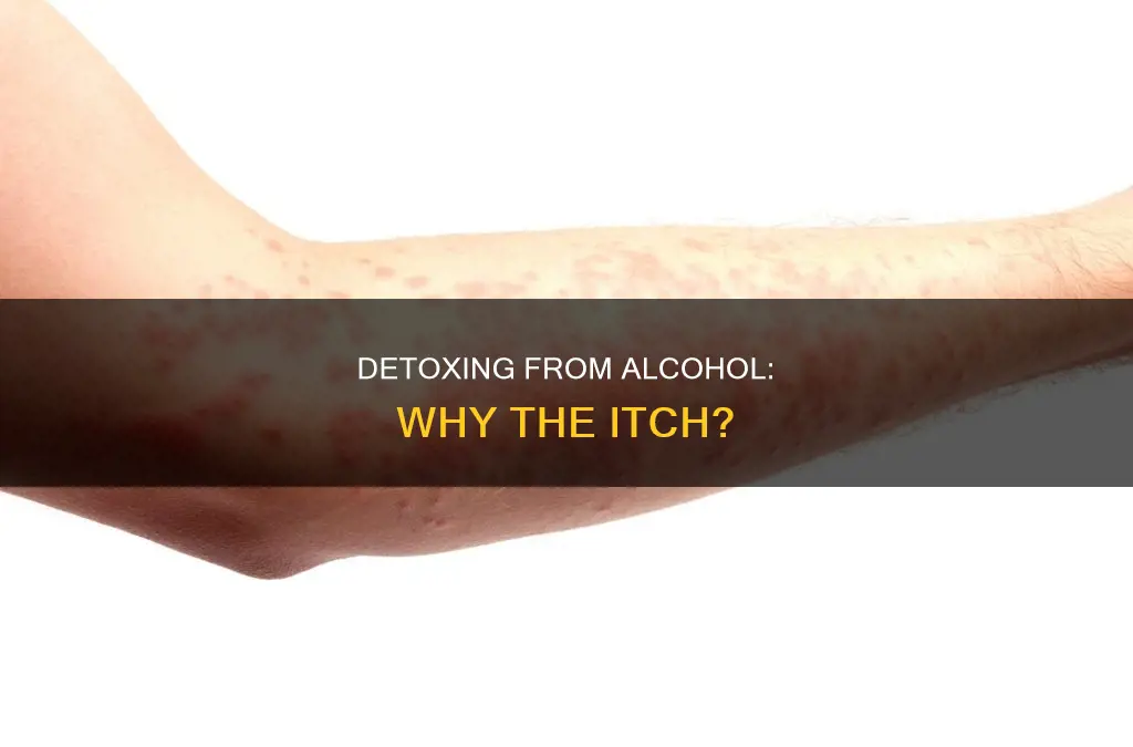Detoxing From Alcohol: Why The Itch? | CyAlcohol