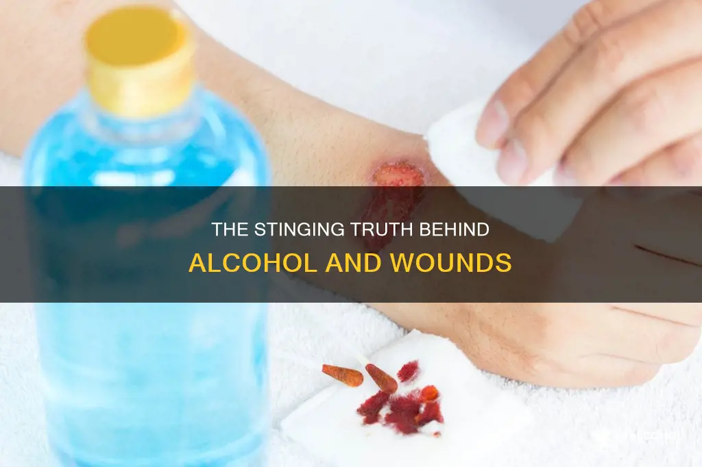 The Stinging Truth Behind Alcohol And Wounds | CyAlcohol