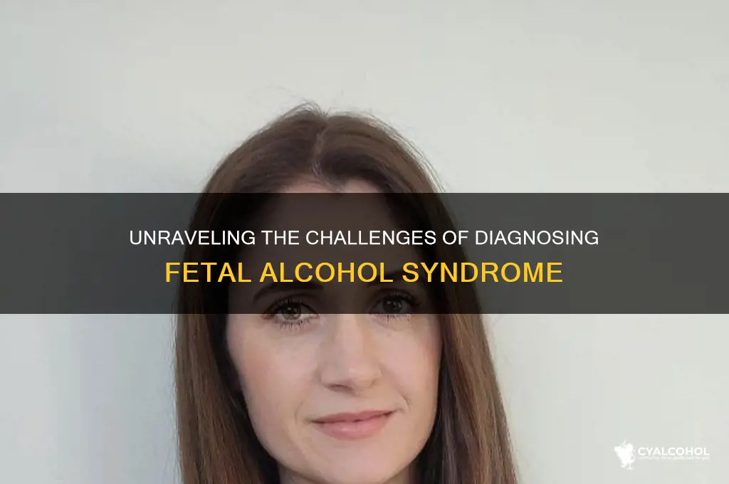 Unraveling The Challenges Of Diagnosing Fetal Alcohol Syndrome | CyAlcohol